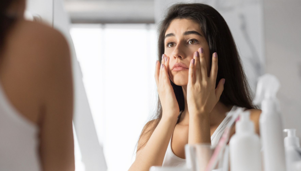 Skin Purging: che cos’è e come affrontarlo