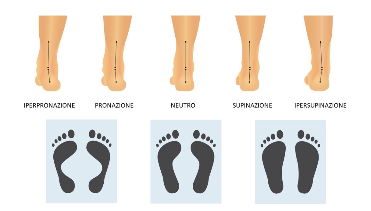 Appoggio del piede: perché è importante e come capire qual è il tuo