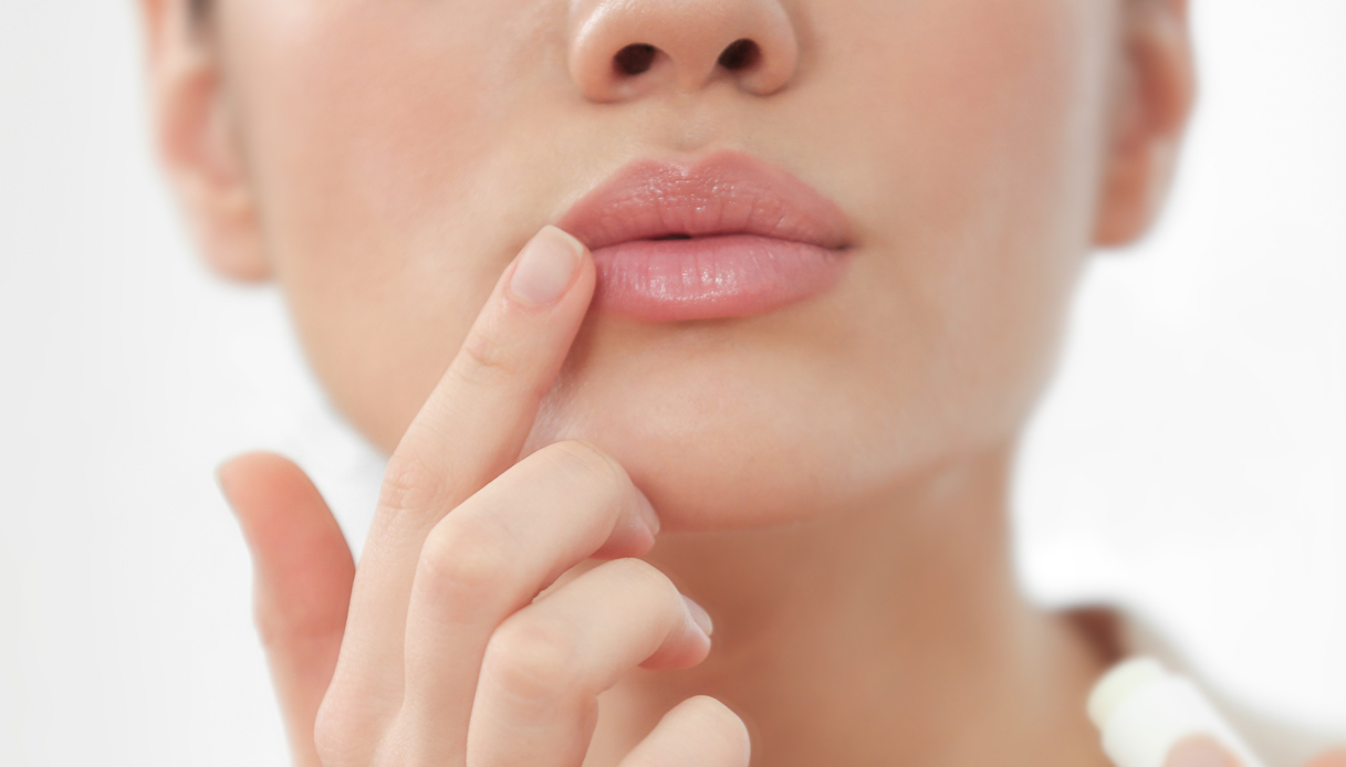 Herpes labialis: cause, trattamenti e il ruolo dell’alimentazione