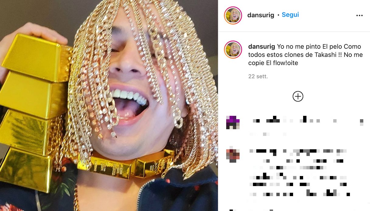 Chi è Dan Sur, la star di TikTok dai capelli d’oro