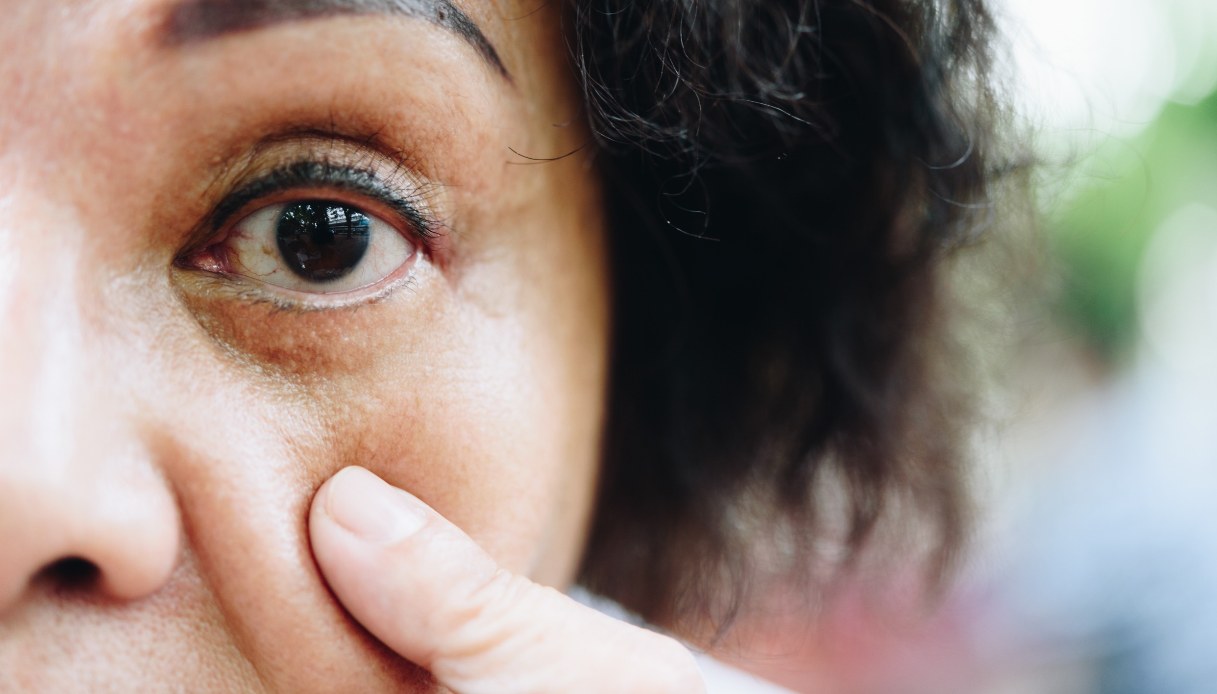 Distacco della retina: cos’è, sintomi e come curarlo